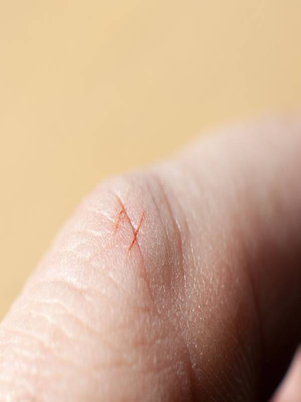 Why do some people get paper cuts? - MindStick YourViews – MindStick ...