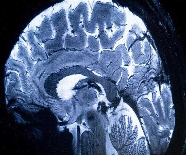 Human Brain's first images come in the World's most powerful MRI ...